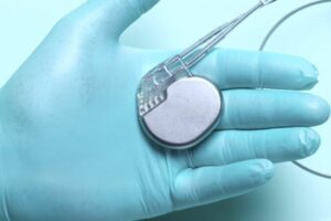 5 key ways to look after your new pacemaker - Jonathan Lyne