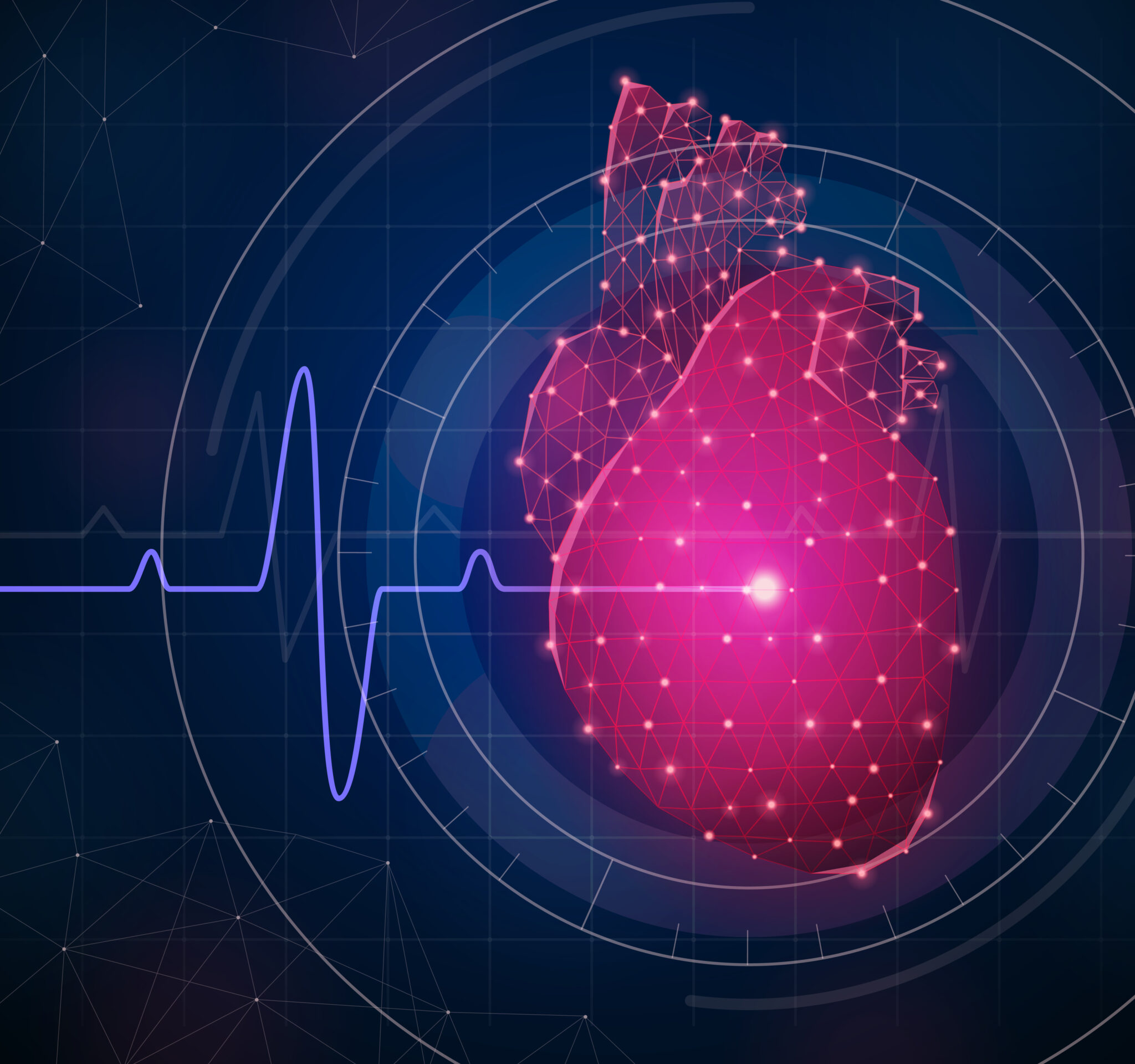 What is Atrial Fibrillation? - Heart Rhythm Cardiologist